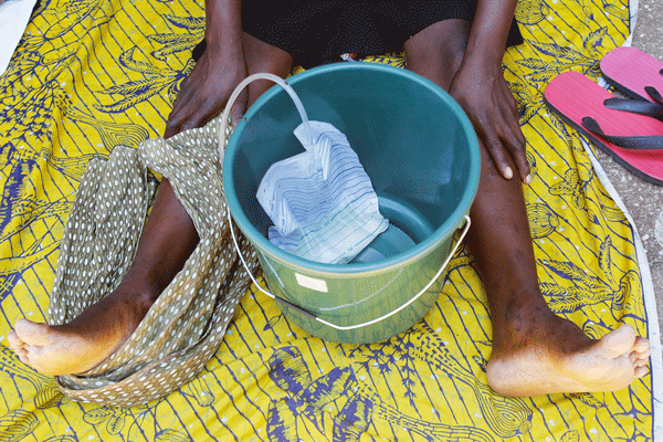 WFP, UNFPA partners govt in fighting obstetric fistula -Newsday Zimbabwe